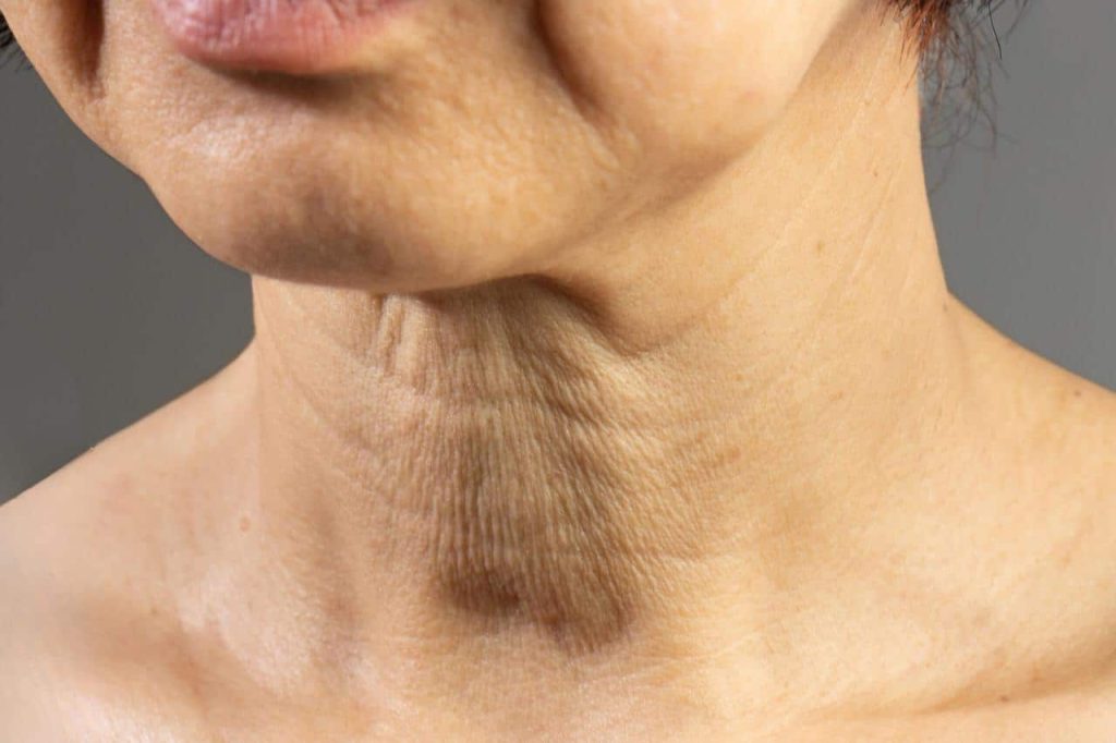 Neck Rejuvenation Package from CosMedic You Must Take! - Best Bali ...